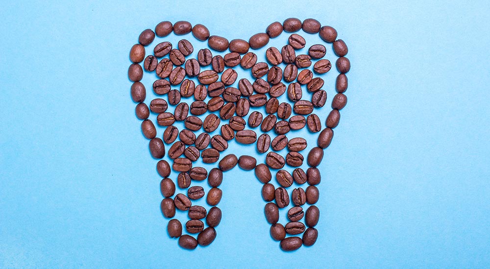 Simple Methods to Having a Whiter Smile: What Stains Your Teeth and Why ...