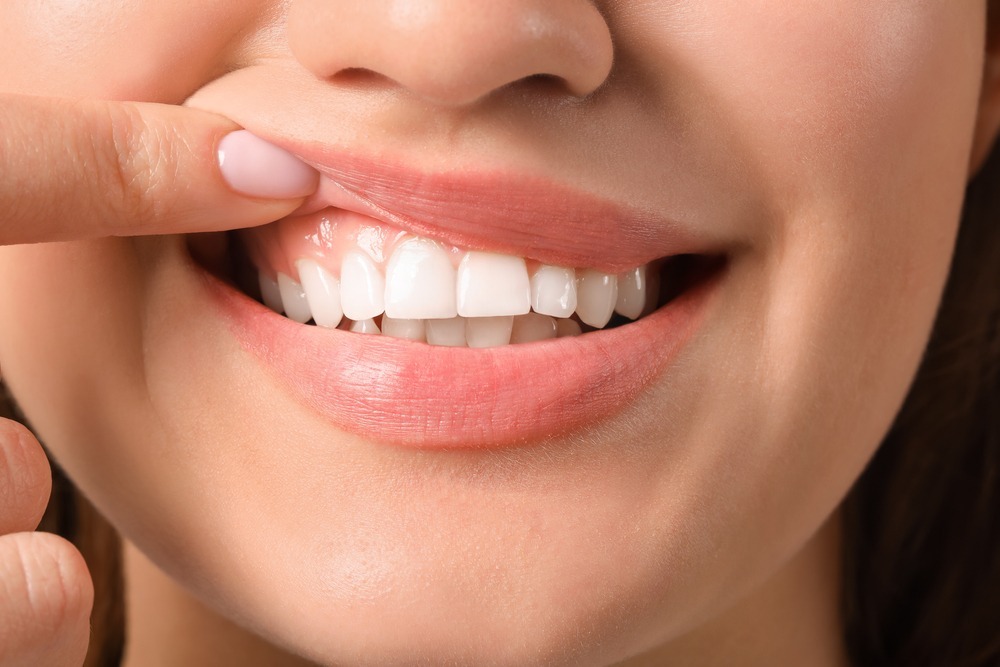 Gum Care Month: How to Keep Your Gums Healthy - American Dental