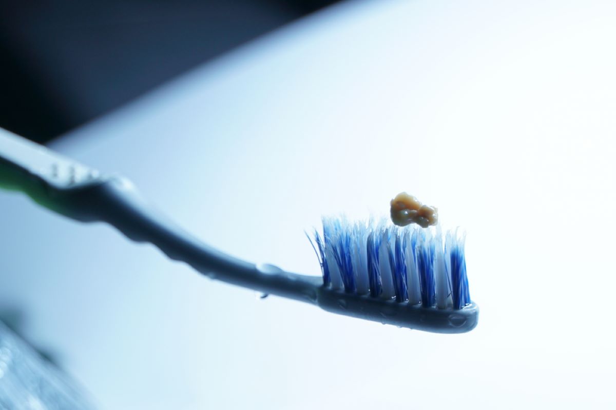 Tonsil Stones What Are They and How Can You Prevent Them