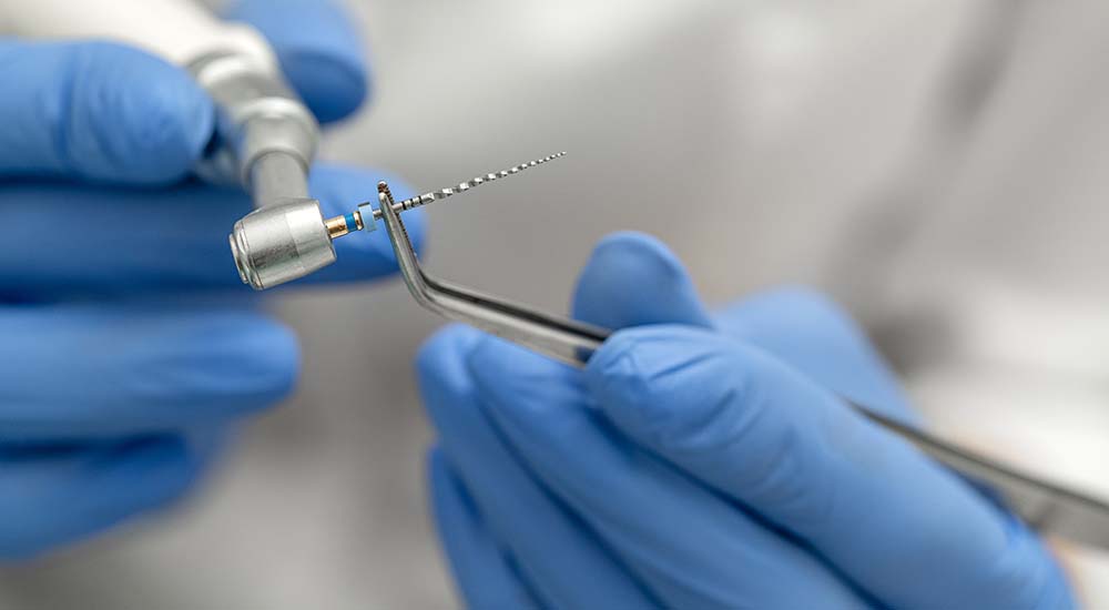 The Enduring Legacy of Endodontics: A Brief Journey Through Time ...